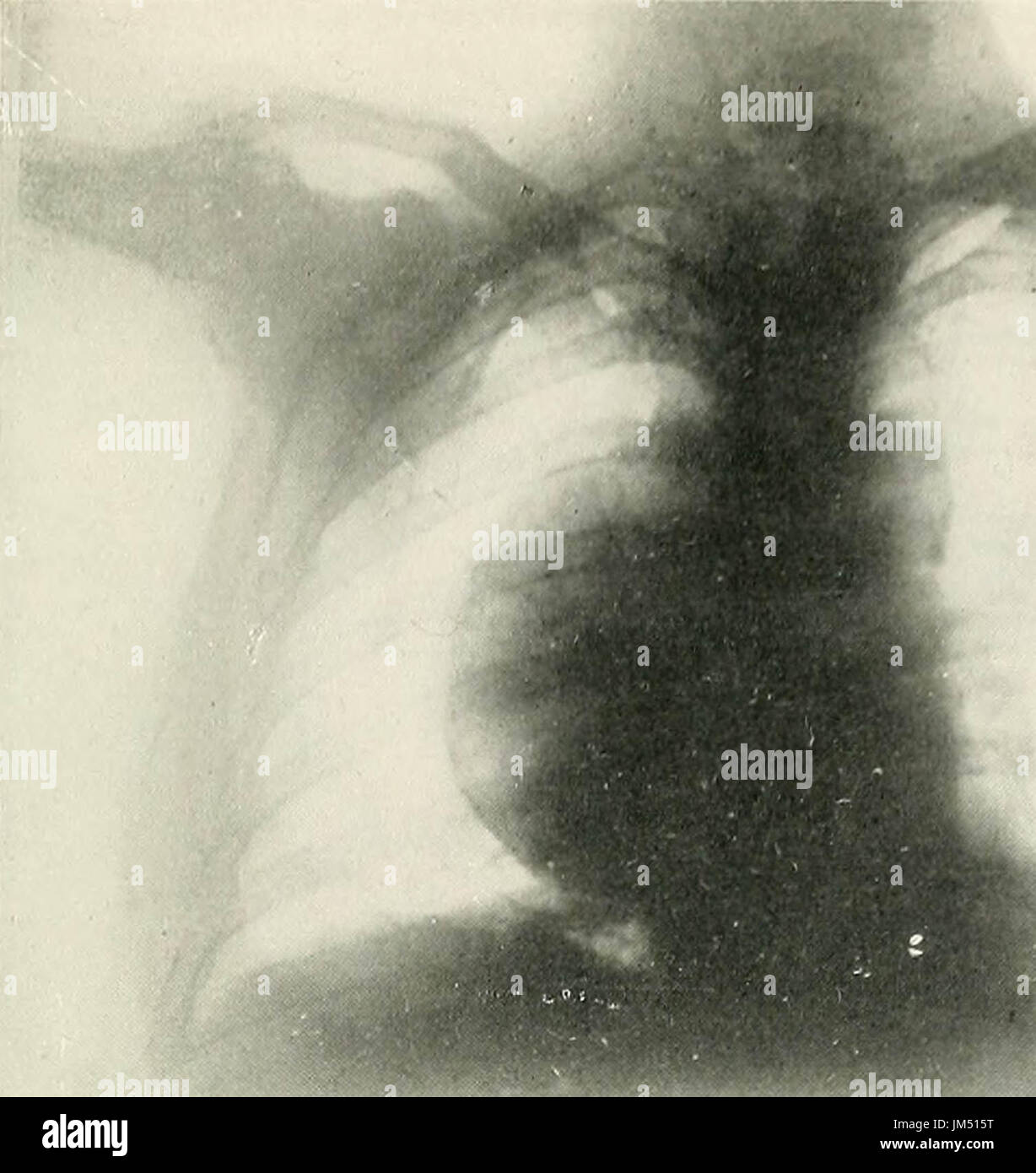 "Radio-diagnosis of pleuro-pulmonary affection" (1918 Stock Photo - Alamy