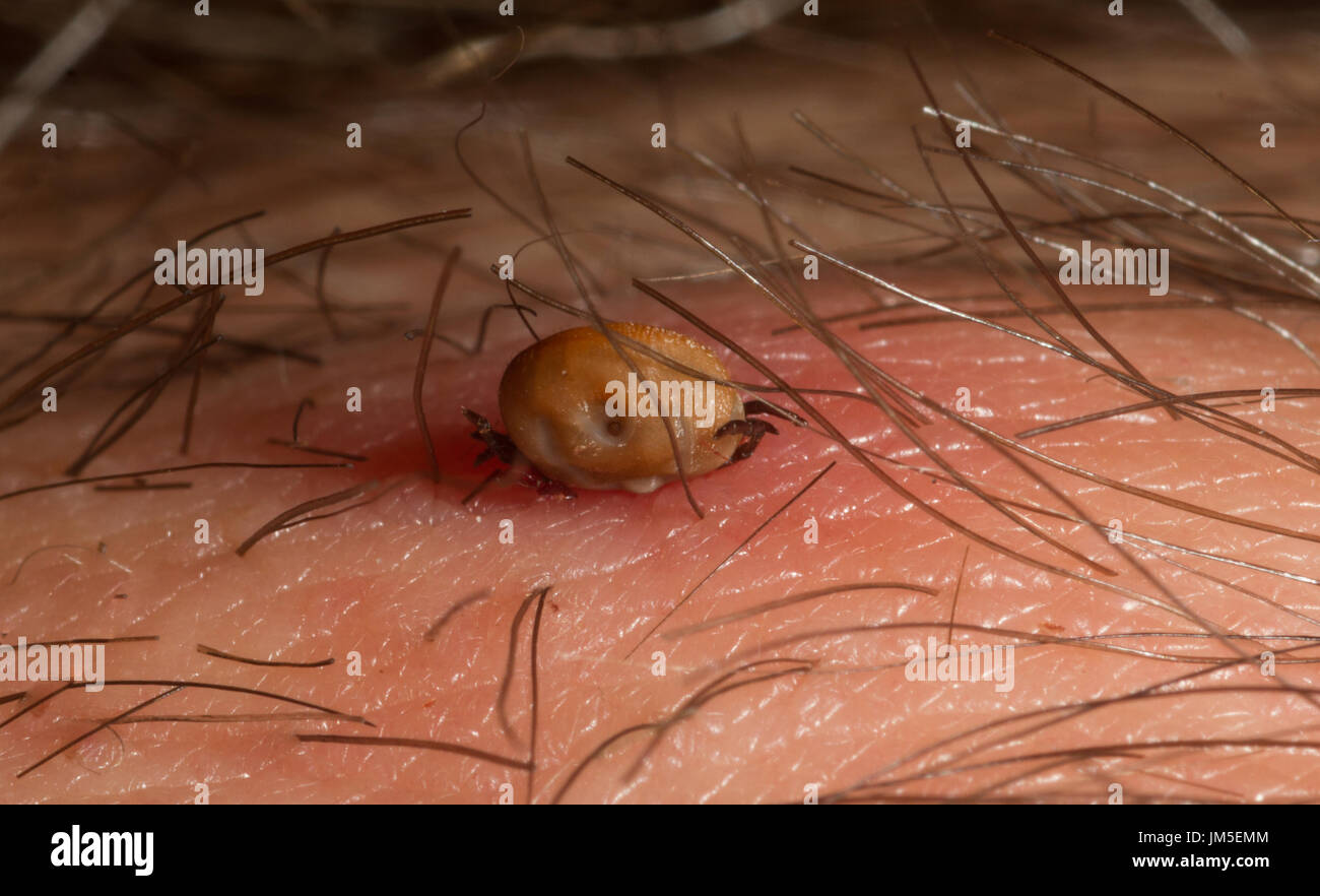 Human Ticks