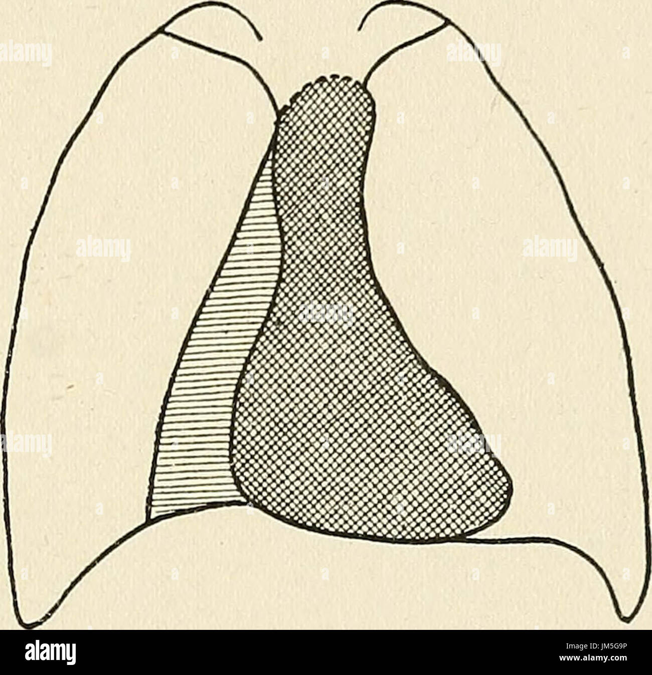"Radio-diagnosis of pleuro-pulmonary affection" (1918 Stock Photo - Alamy