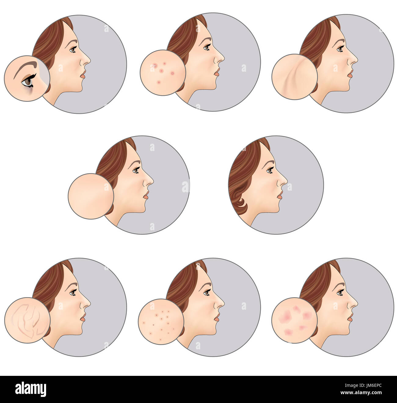 Skincare label vector set. Woman's skin before and after the procedure ...