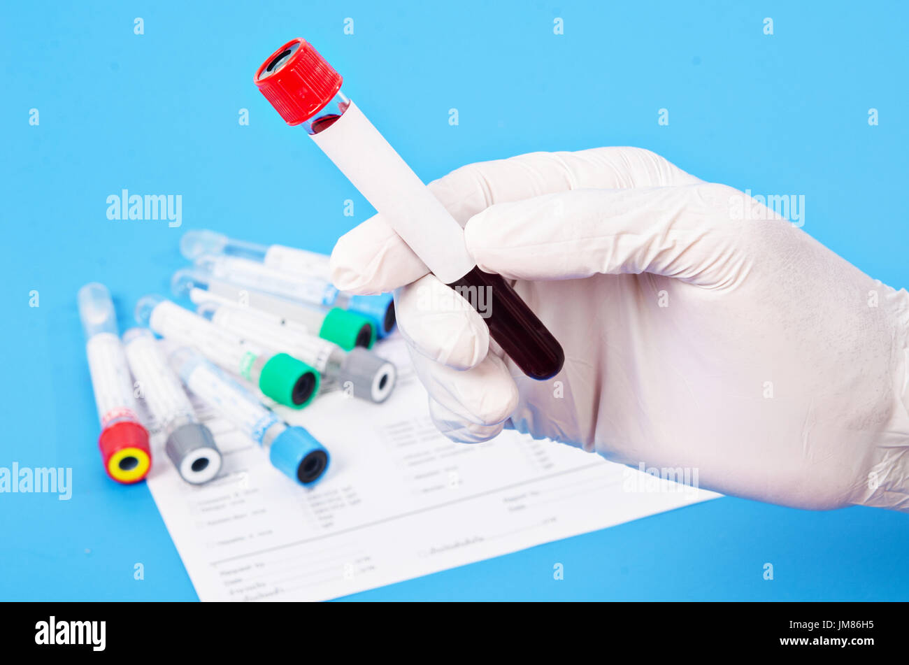 Hand holding Vacuum blood tubes for collecting blood samples in the ...