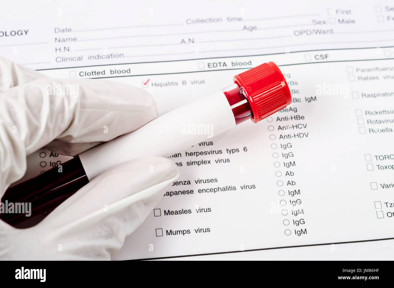 Hand holding Blood tube for hepatitis testing in laboratory Stock Photo ...