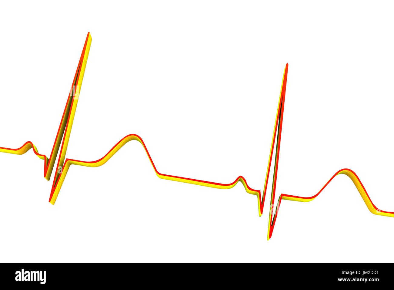 ECG. Computer illustration of an electrocardiogram (ECG) showing a ...