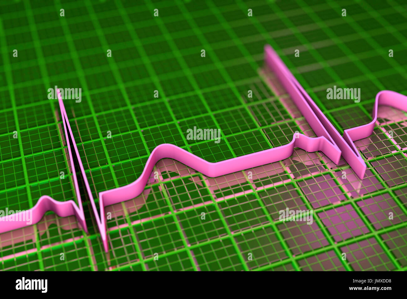 ECG. Computer illustration of an electrocardiogram (ECG) showing a ...