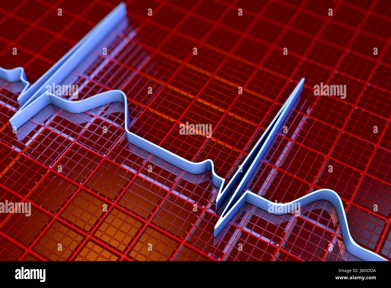 Normal ecg High Resolution Stock Photography and Images - Alamy