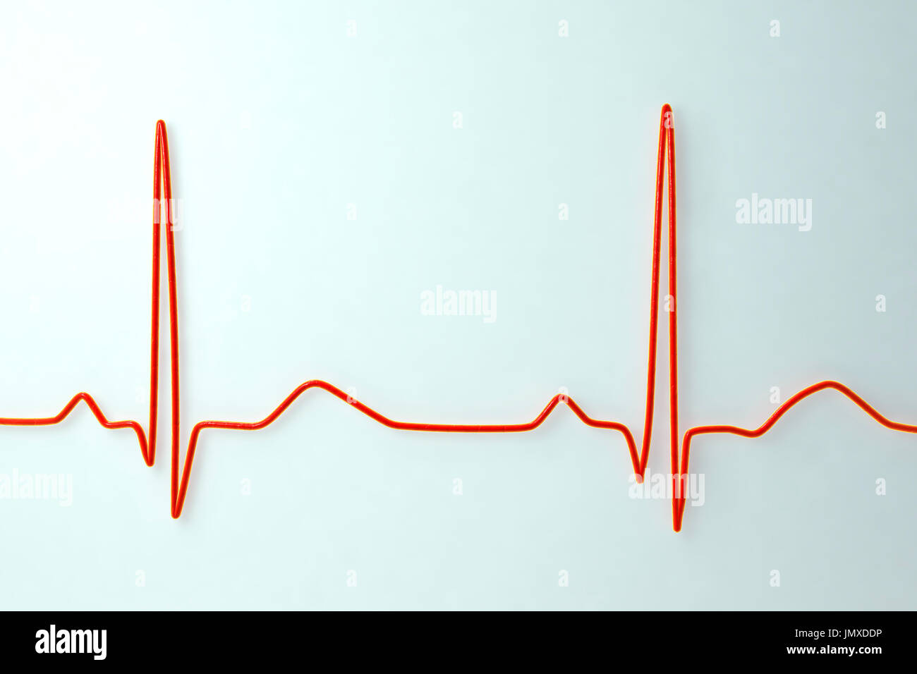 Normal ecg High Resolution Stock Photography and Images - Alamy