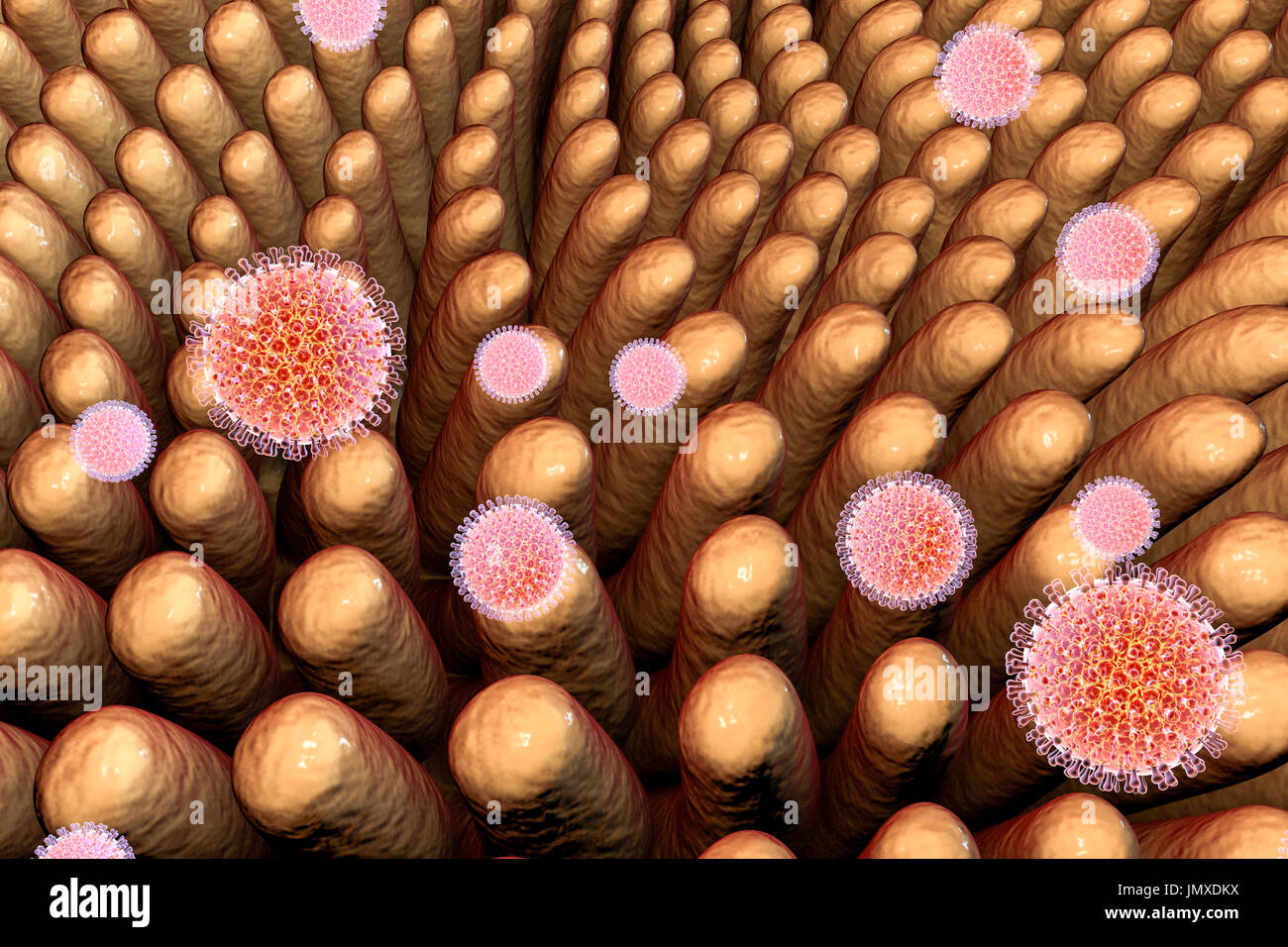 Rotaviruses infecting intestine, computer illustration. The virus ...