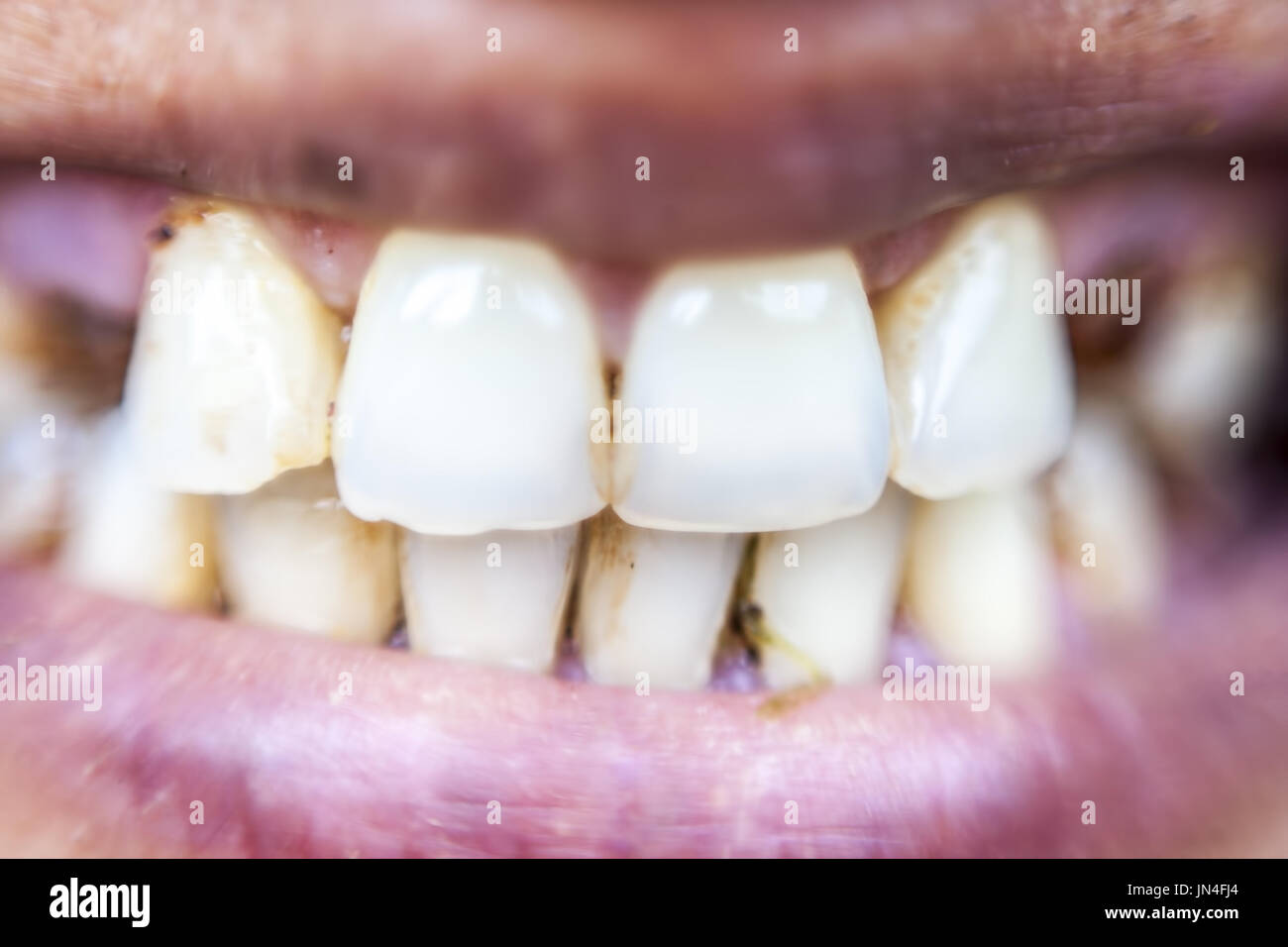 dirty female teeth Stock Photo - Alamy