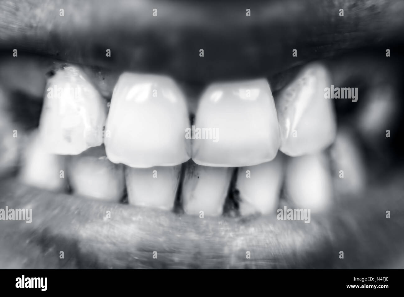 dirty female teeth Stock Photo - Alamy