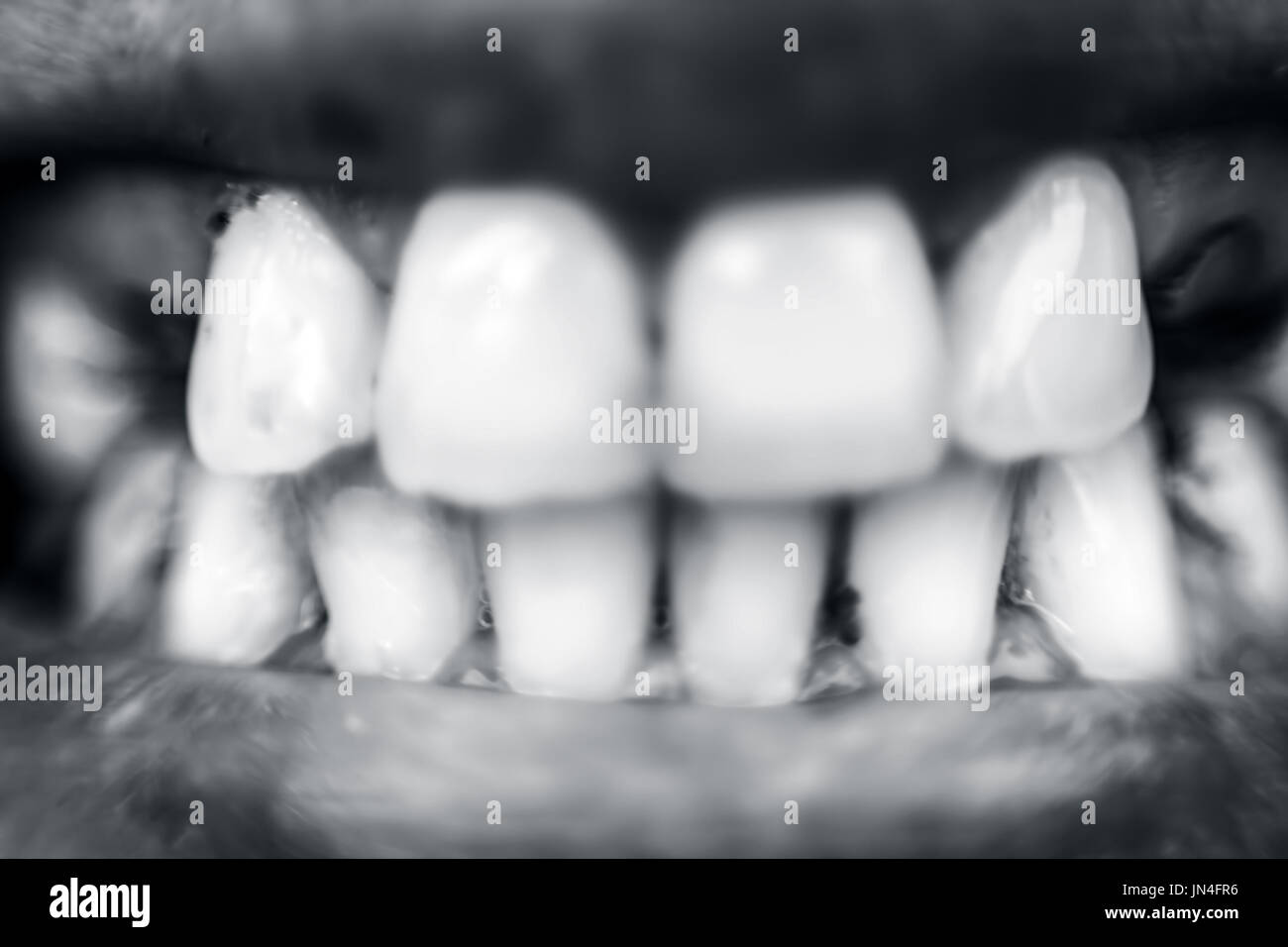 dirty female teeth Stock Photo - Alamy