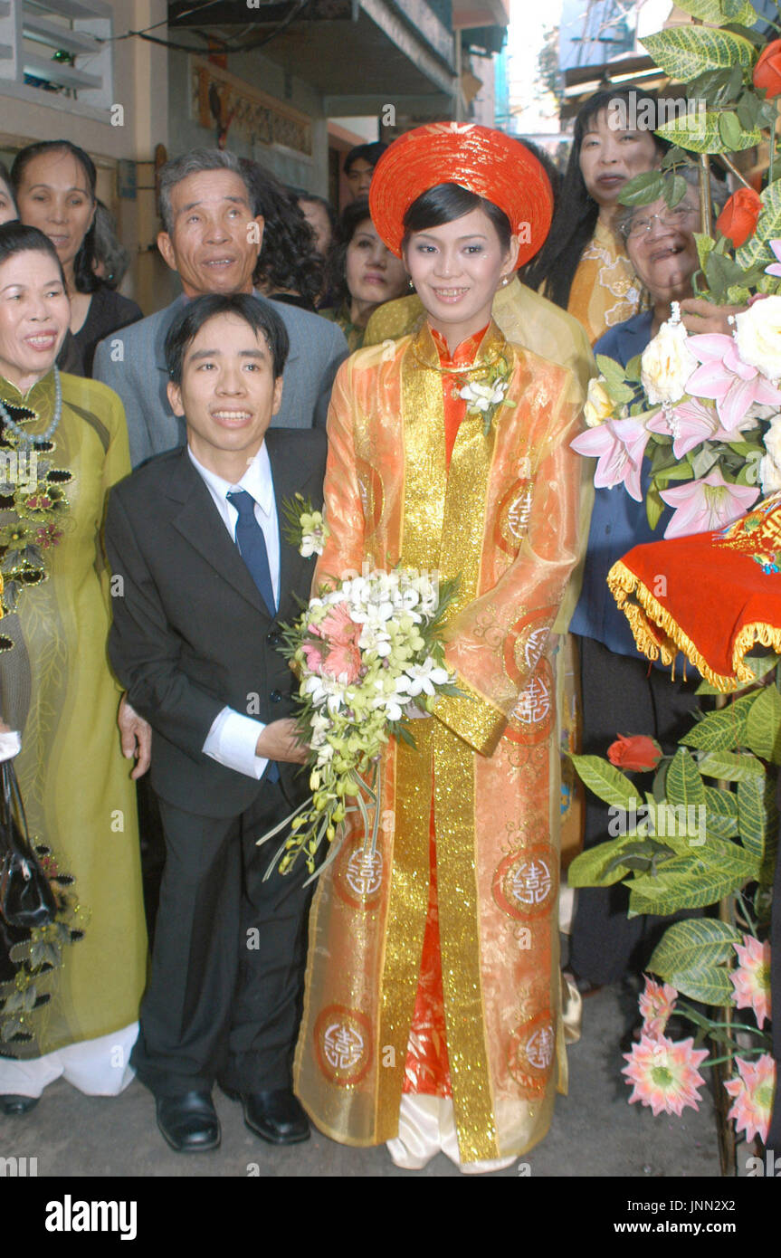 HO CHI MIHN CITY, Vietnam - Nguyen Duc (L), 25, who had been a conjoined Vietnamese twin until ...