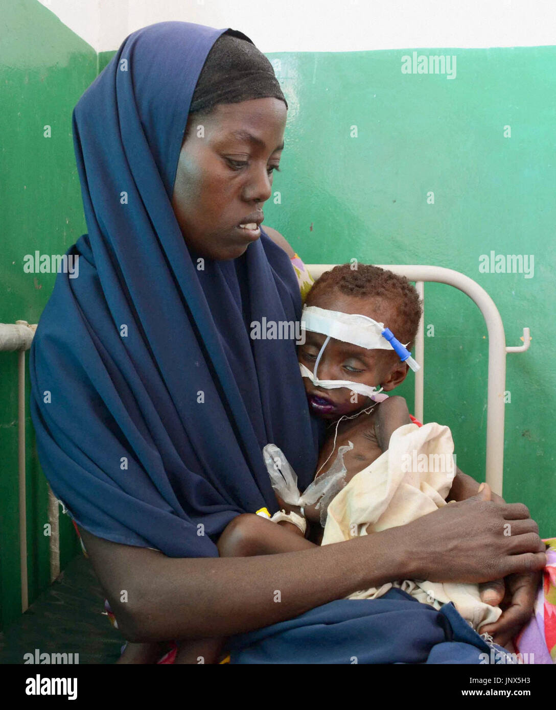 TOKYO, Japan - A woman holds her malnourished child at a hospital in ...