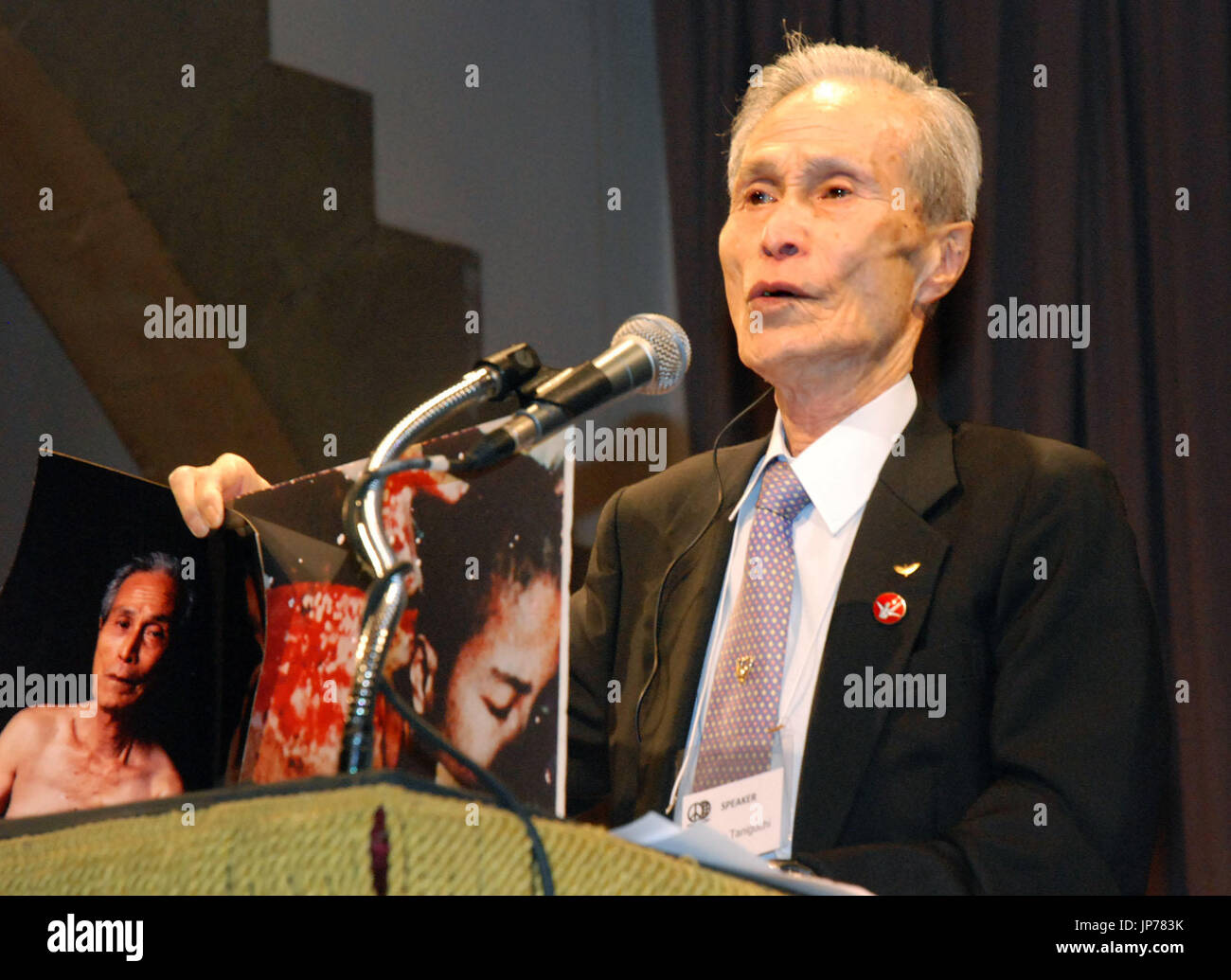 Sumiteru Taniguchi, a survivor of the atomic bombing of Nagasaki, shows ...