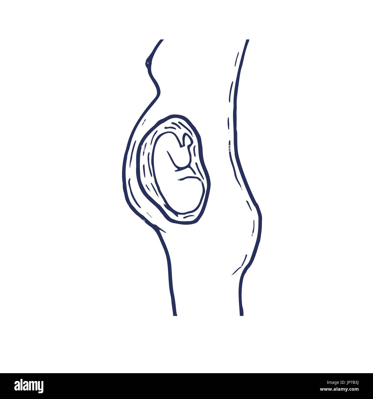 Woman and pregnancy hand drawn illustration Stock Vector Image & Art ...