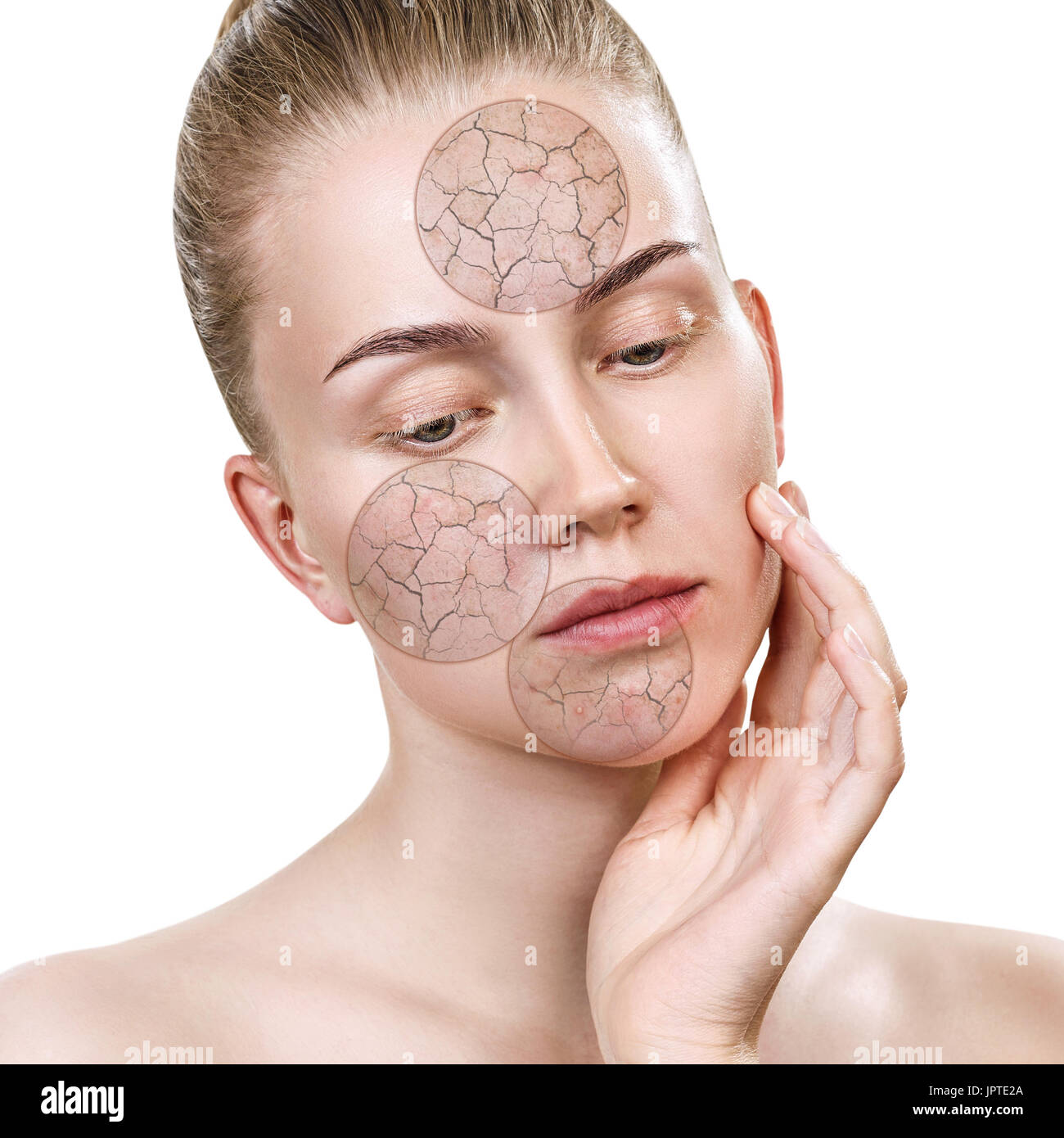 Zoom circle shows facial skin before moistening Stock Photo - Alamy