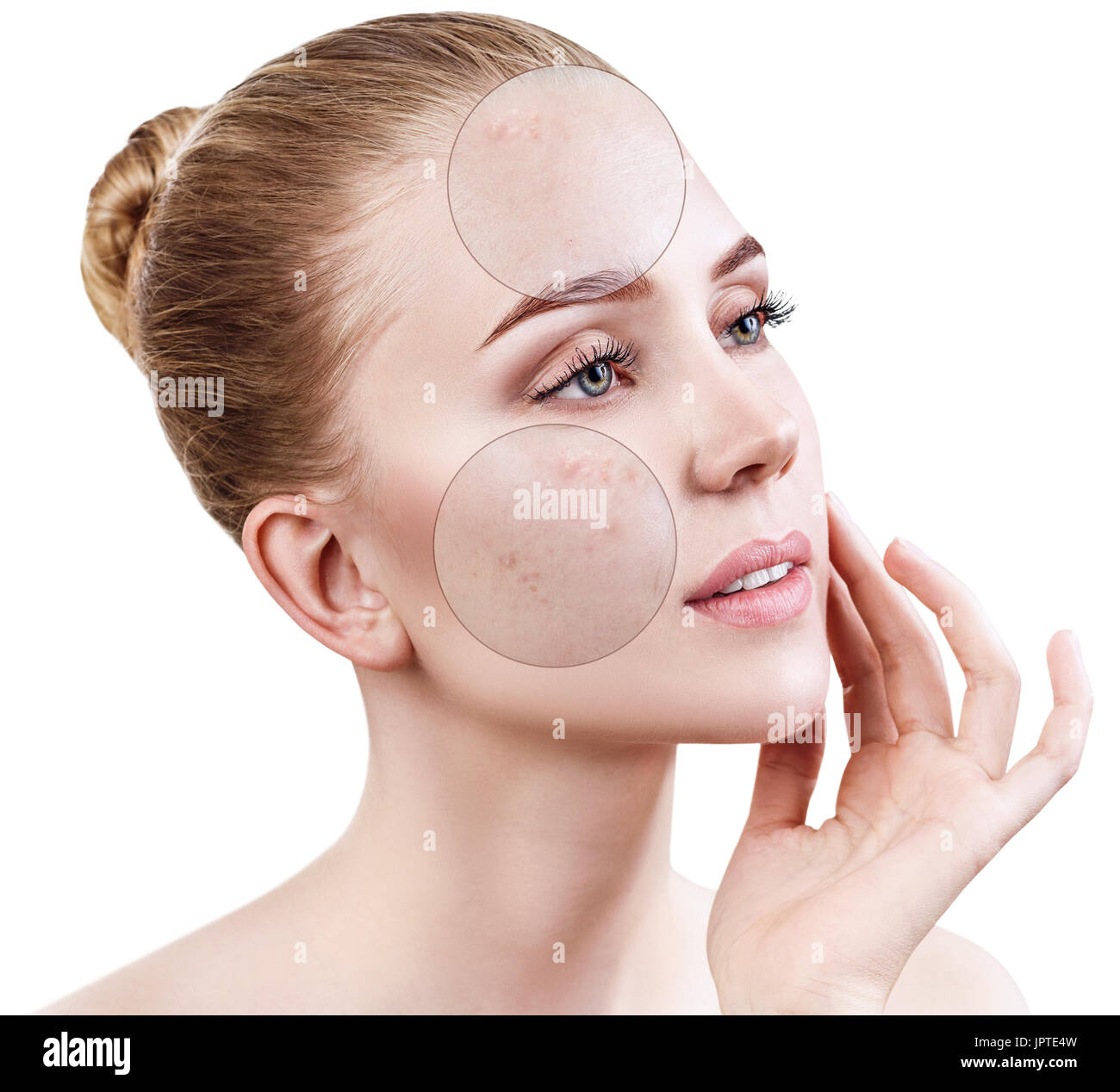 Circles shows problem skin of young woman Stock Photo - Alamy