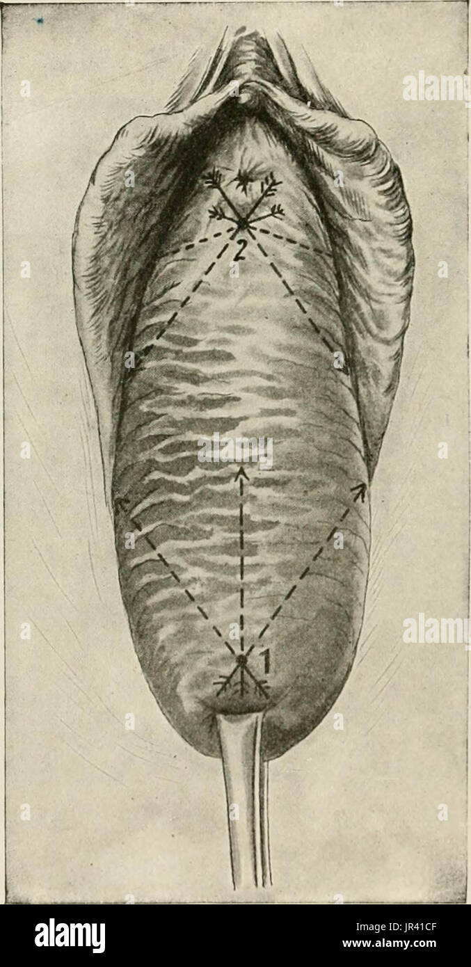 "Local and regional anesthesia; with chapters on spinal, epidural ...