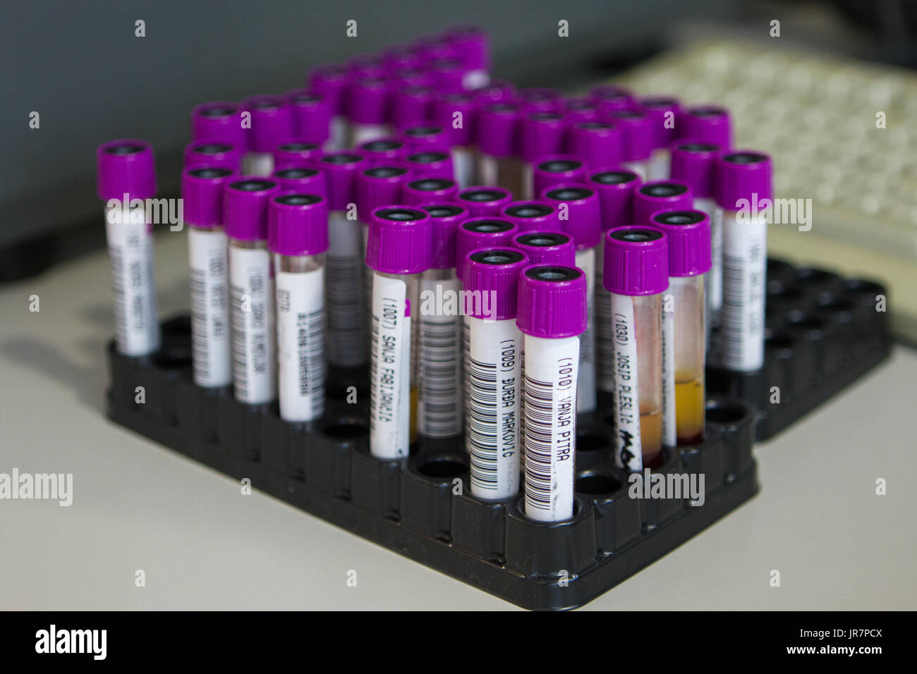 Zagreb, Croatia - June 14, 2017: Blood sample tubes ready for analysis ...