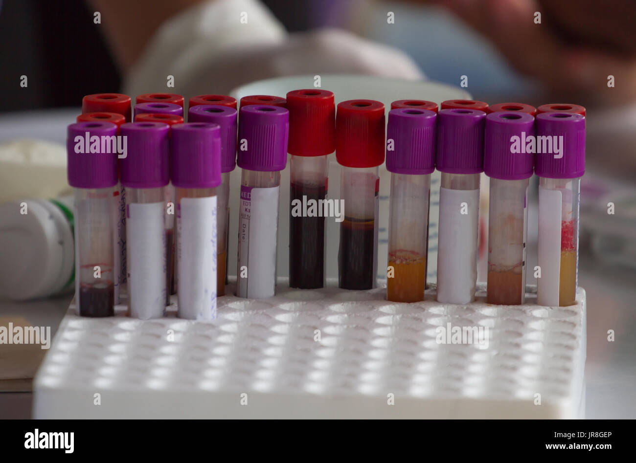close up Blood collection tubes in the laboratory Stock Photo - Alamy