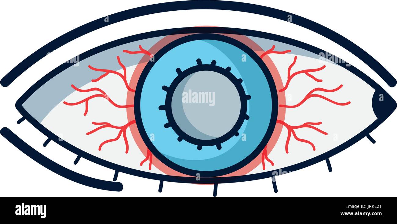 eyes with conjunctivitis sickness and infection Stock Vector Image ...
