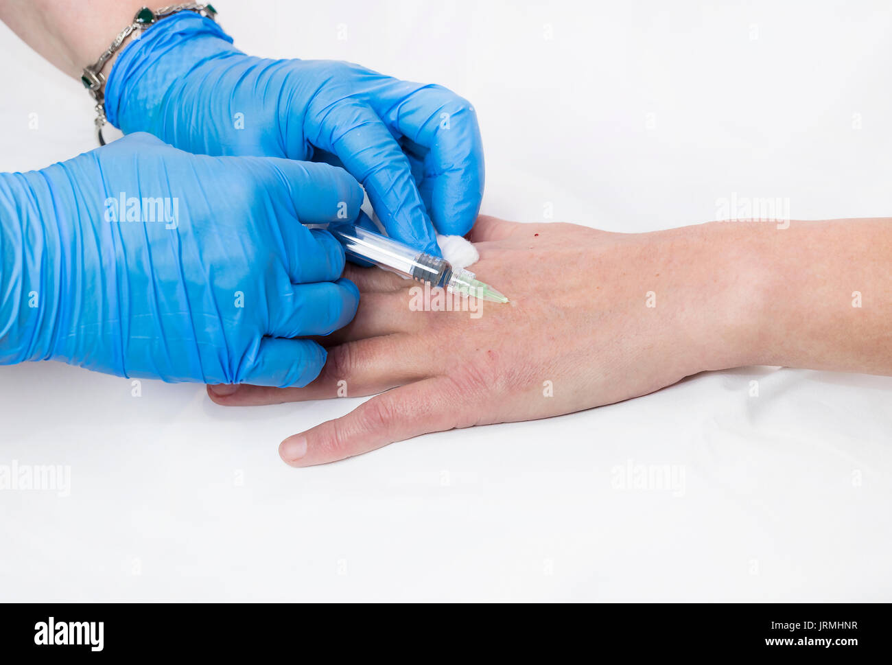 Mesotherapy process on a female hand in clinic Stock Photo - Alamy