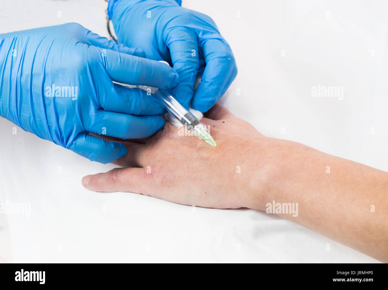 Mesotherapy process on a female hand in clinic Stock Photo - Alamy
