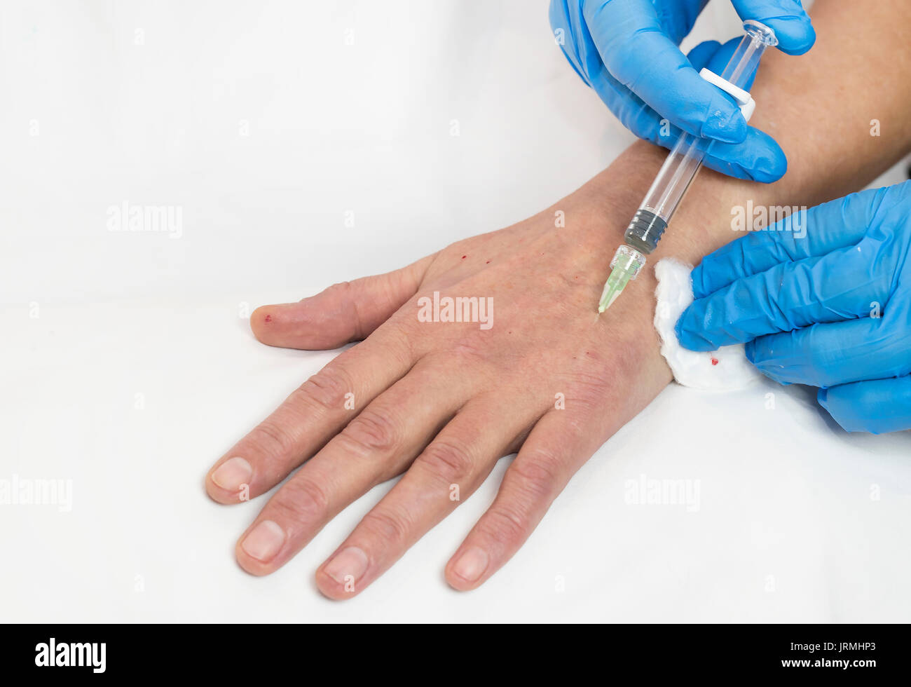 Mesotherapy process on a female hand in clinic Stock Photo - Alamy