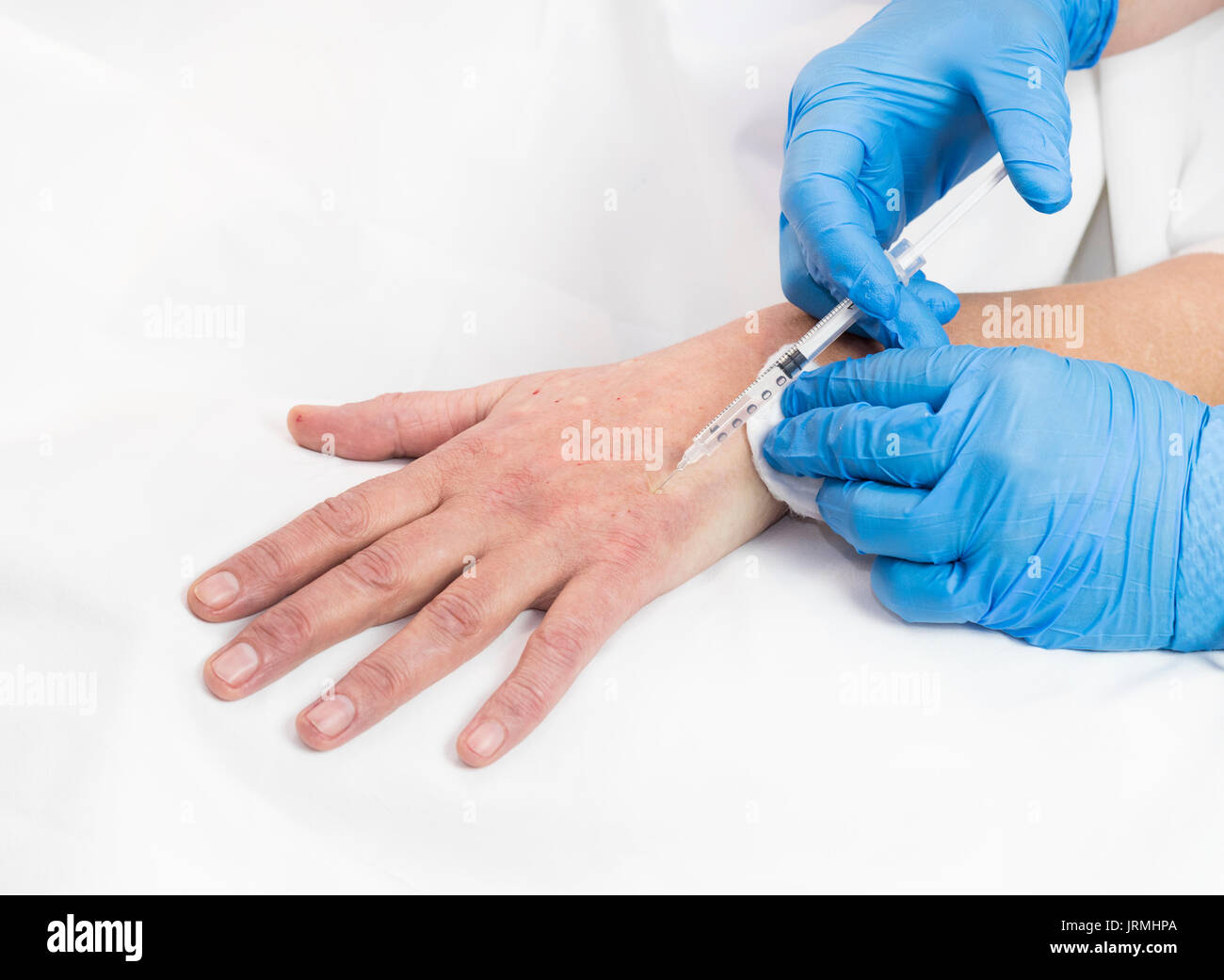 Mesotherapy process on a female hand in clinic Stock Photo - Alamy