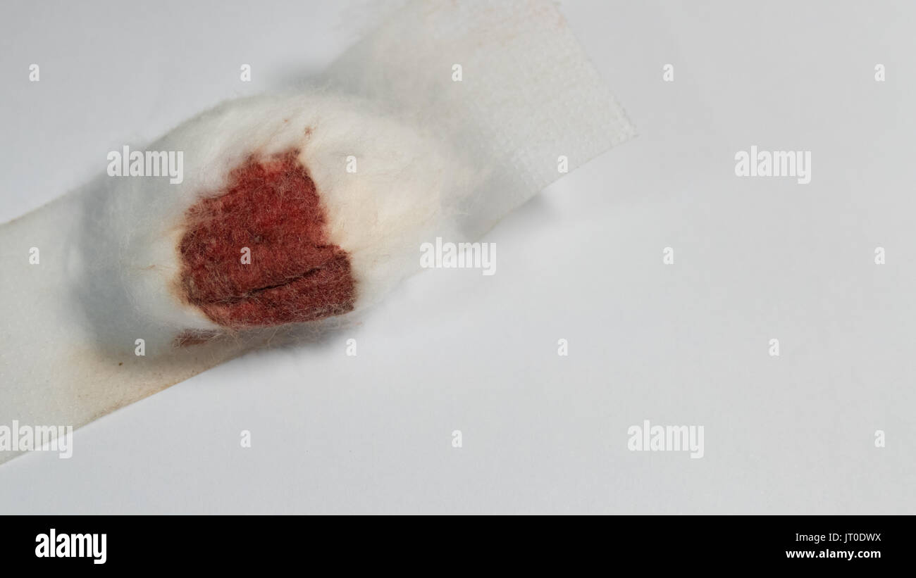 human blood on cotton wool sponge ball on white background. Blood ...