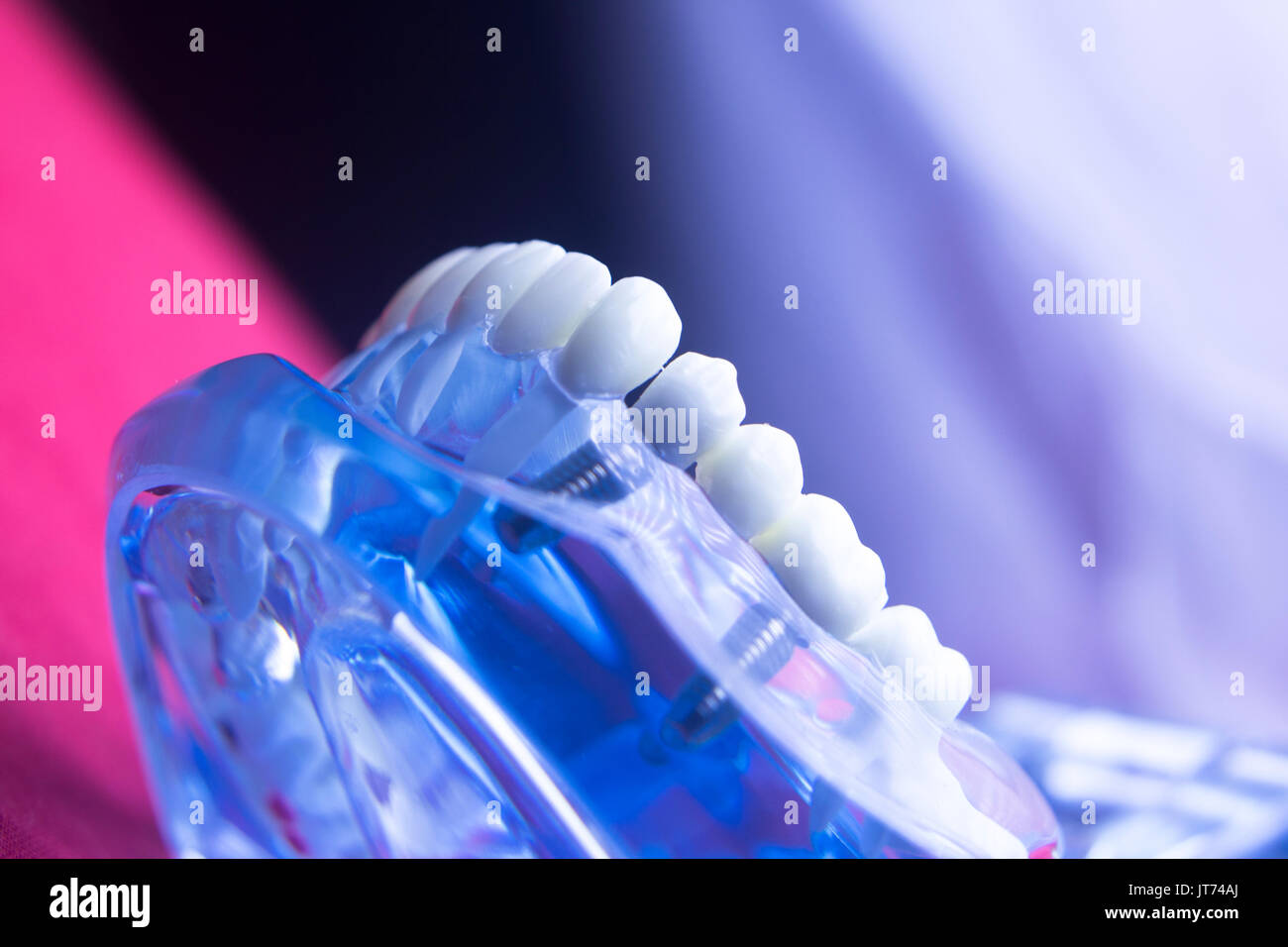 Dentists' dental teeth model showing tooth enamel, gums, roots, plaque ...