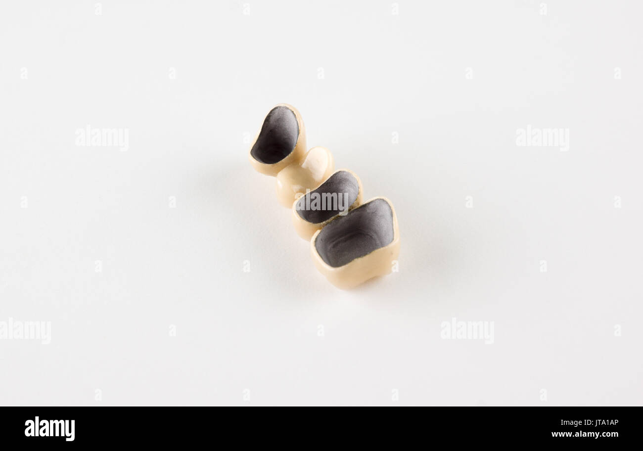 Artificial teeth are made of ceramics for the patient Stock Photo - Alamy