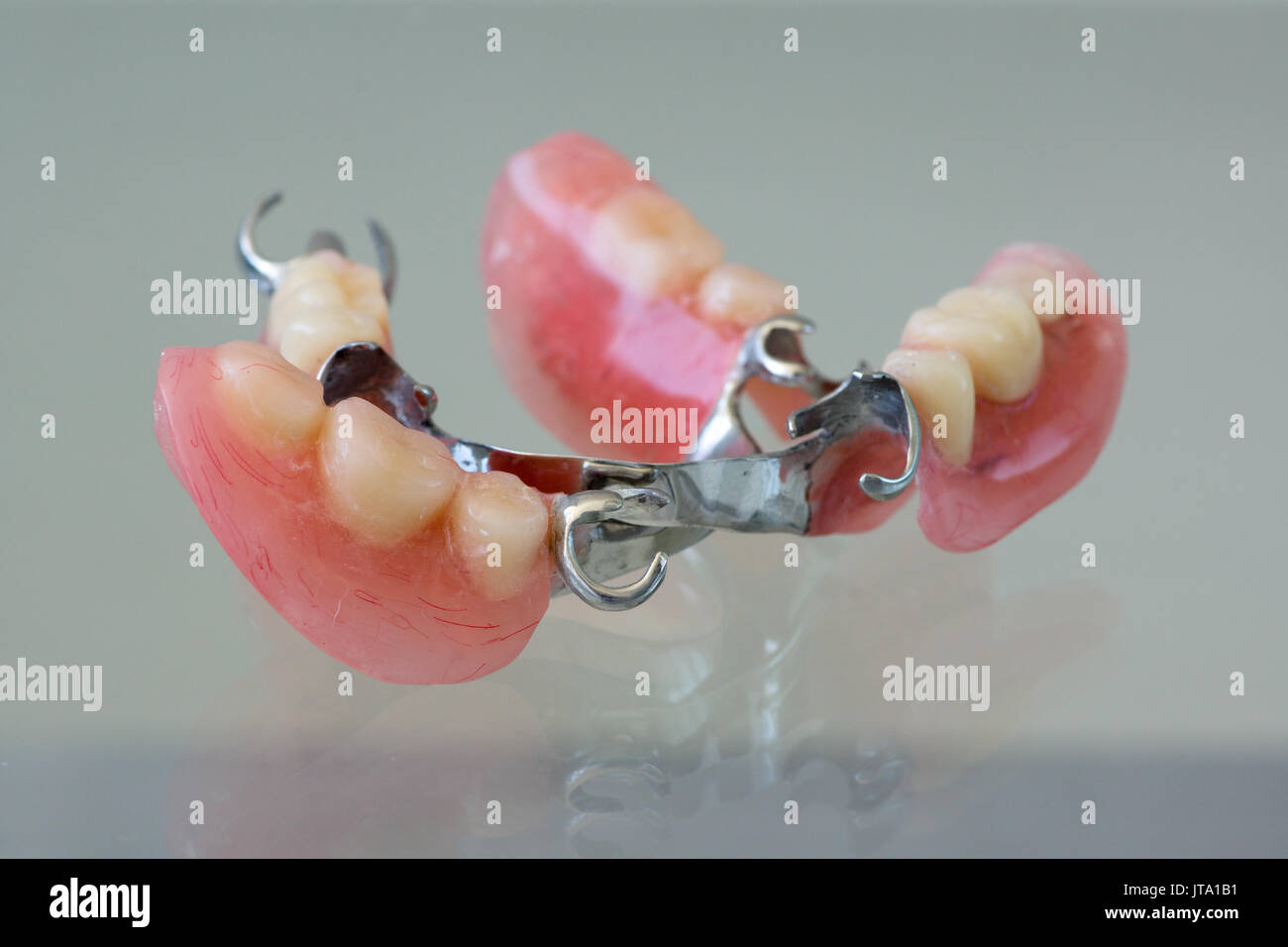 Clasp denture with a metal arc and artificial teeth Stock Photo - Alamy