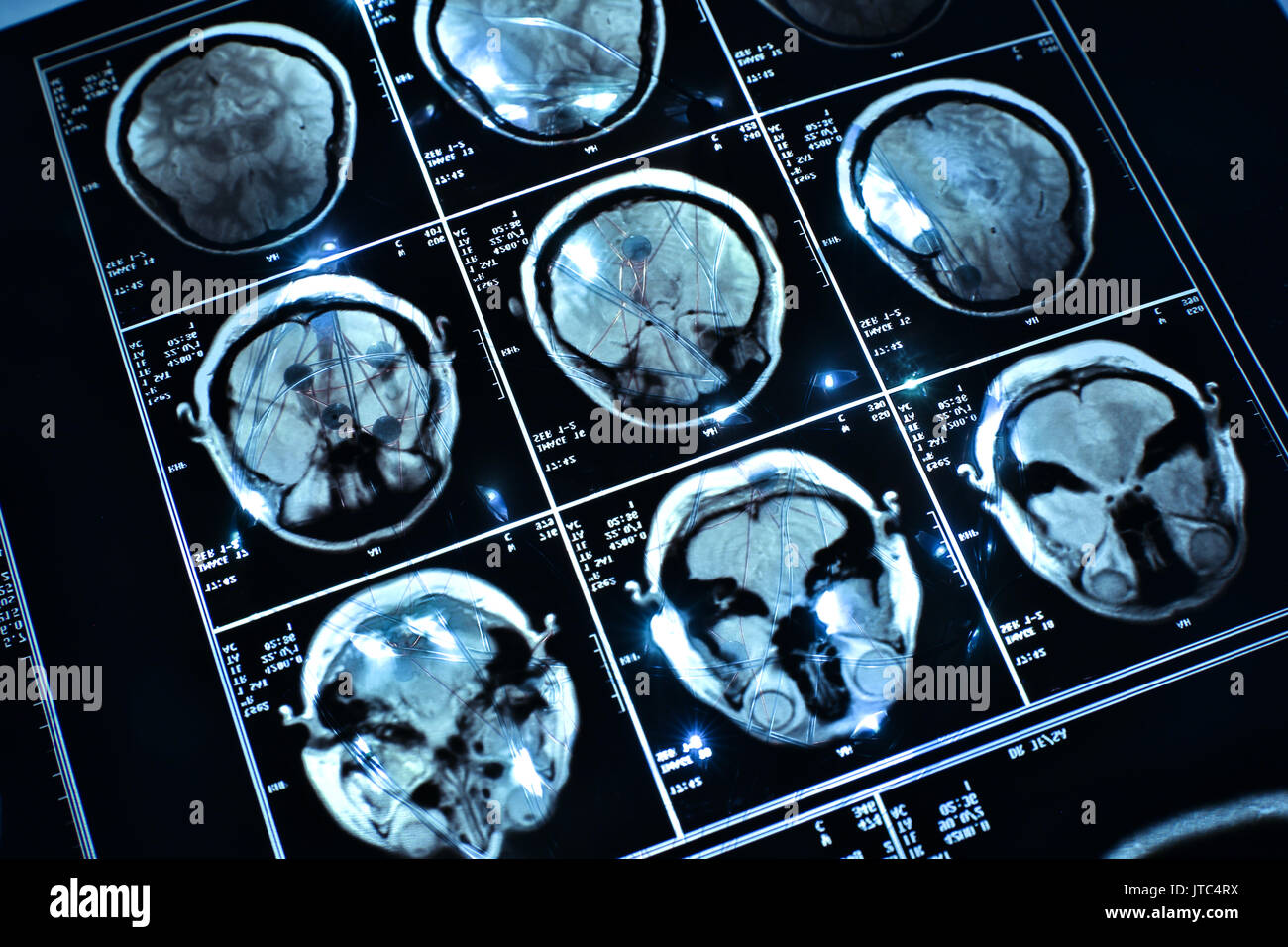 Brain neurons scan hi-res stock photography and images - Alamy