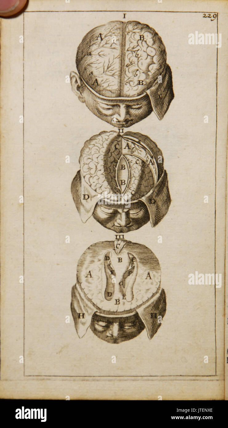 Wesling Kuenstliche Zerlegung 288 Stock Photo - Alamy