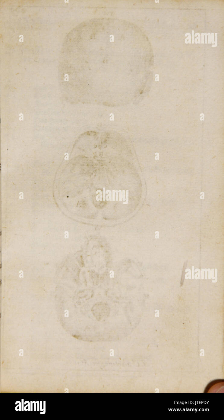 Wesling Kuenstliche Zerlegung 265 Stock Photo - Alamy