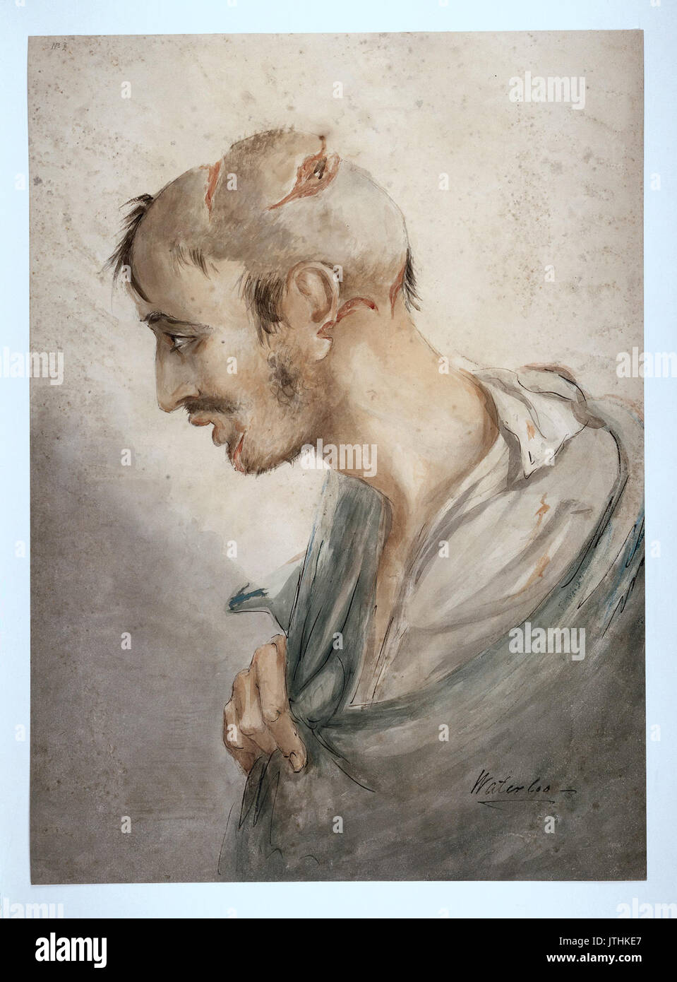 War injuries wwi hi-res stock photography and images - Alamy