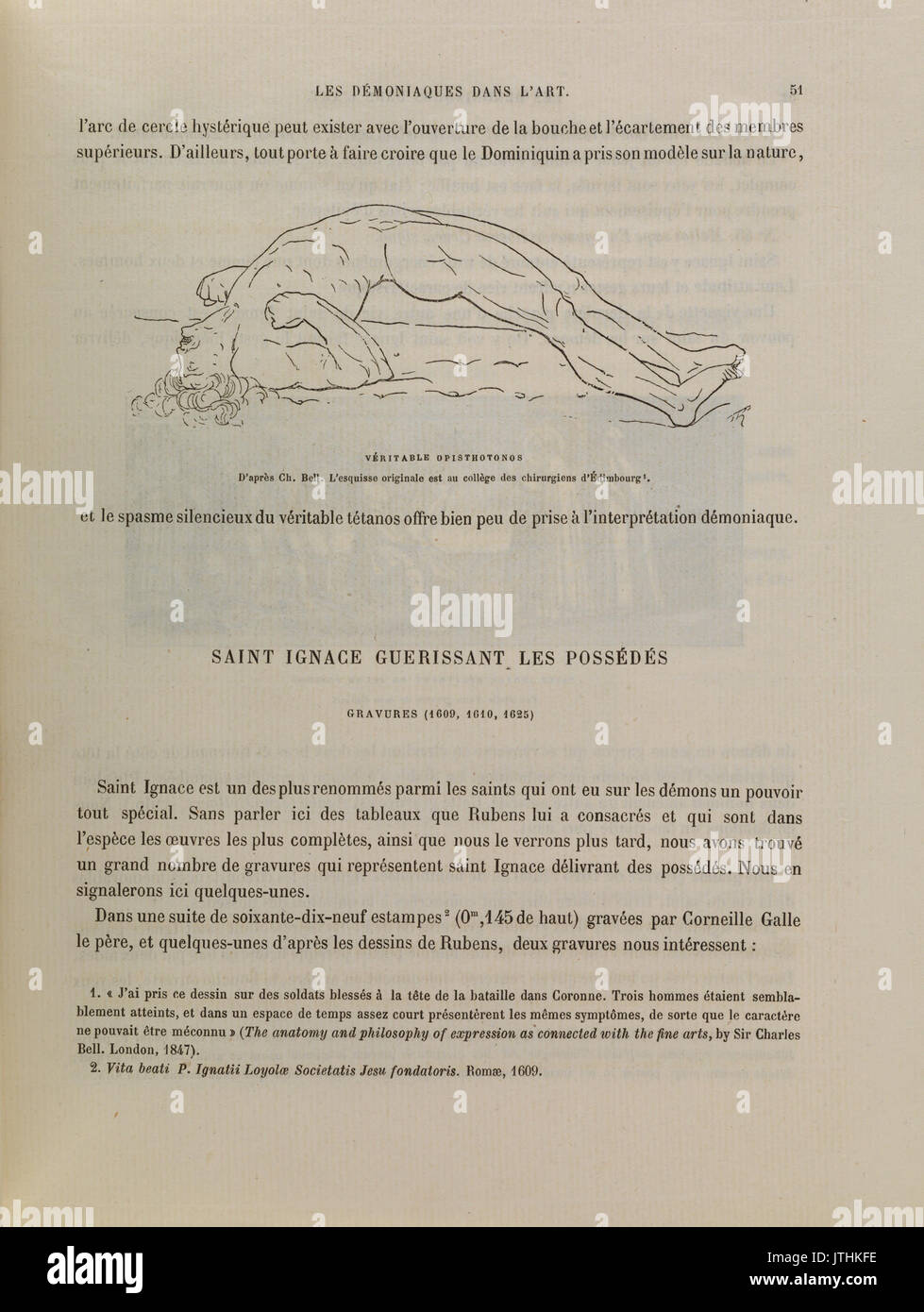 Opisthotonos hi-res stock photography and images - Alamy