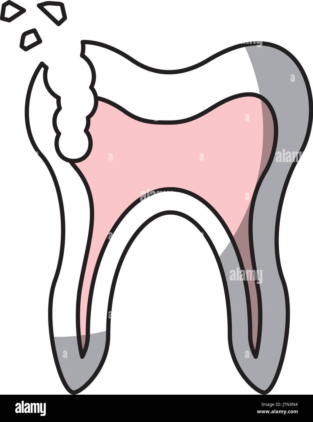 Human tooth decay Stock Vector Images - Alamy