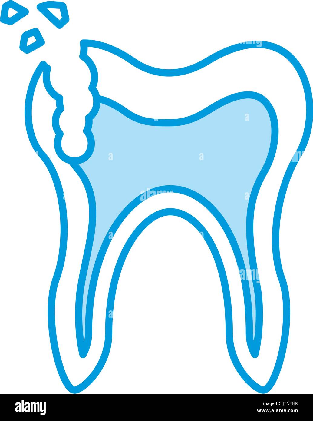 Human tooth with decay Stock Vector Image & Art - Alamy