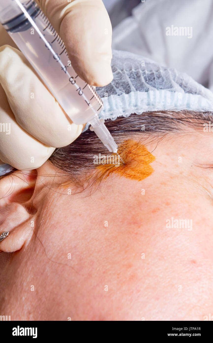 Local anesthesia hi-res stock photography and images - Alamy
