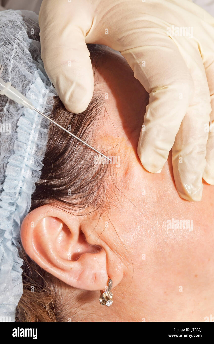 Dermatologist performs local facial anesthesia to prepare patient for ...