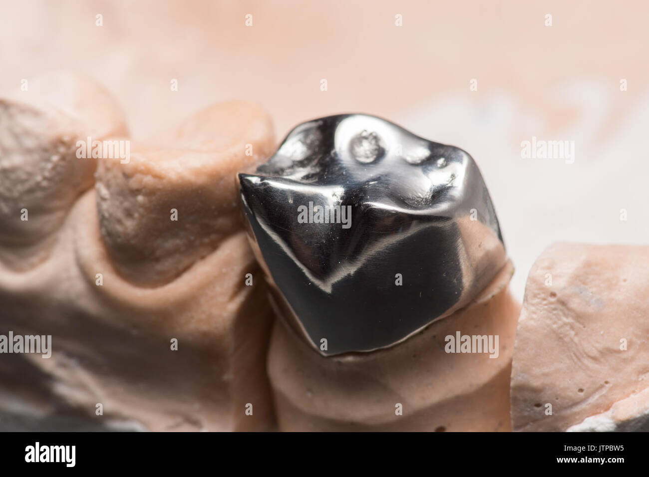 Steel artificial dental crown for dentition restoration Stock Photo - Alamy