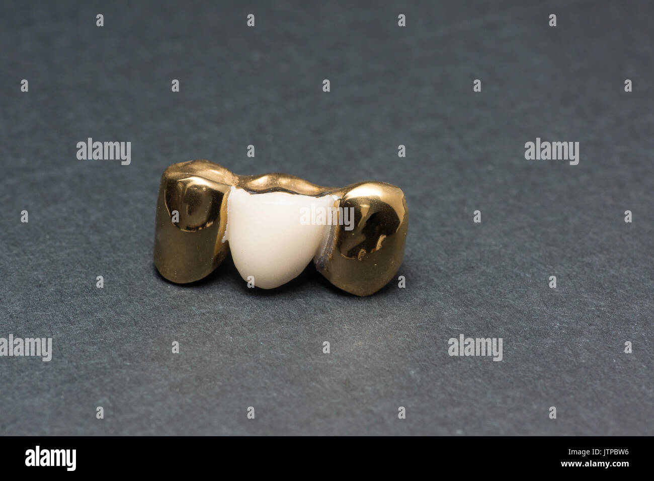 Steel artificial dental crown for dentition restoration Stock Photo - Alamy