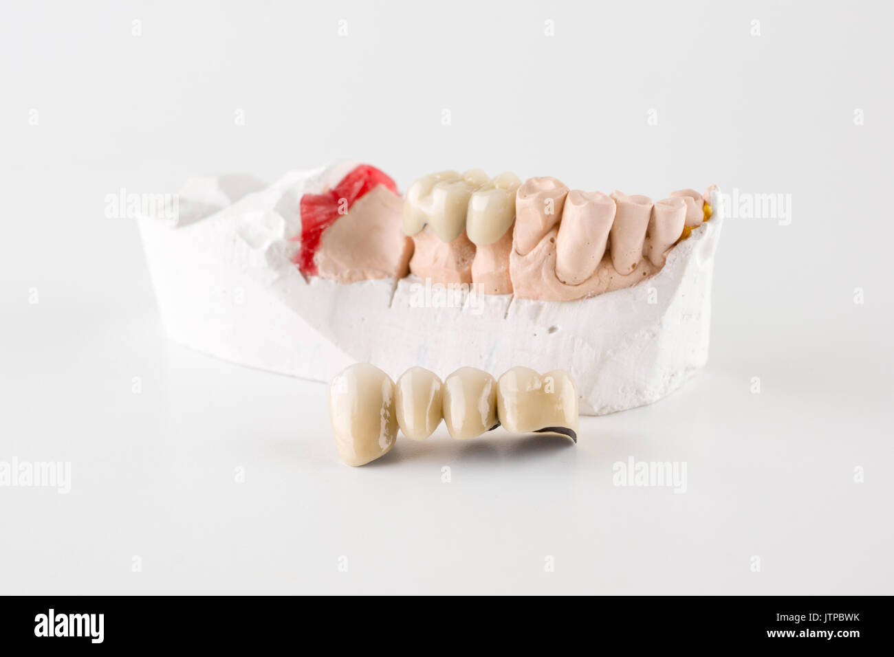 Artificial teeth are made of ceramics for the patient Stock Photo - Alamy