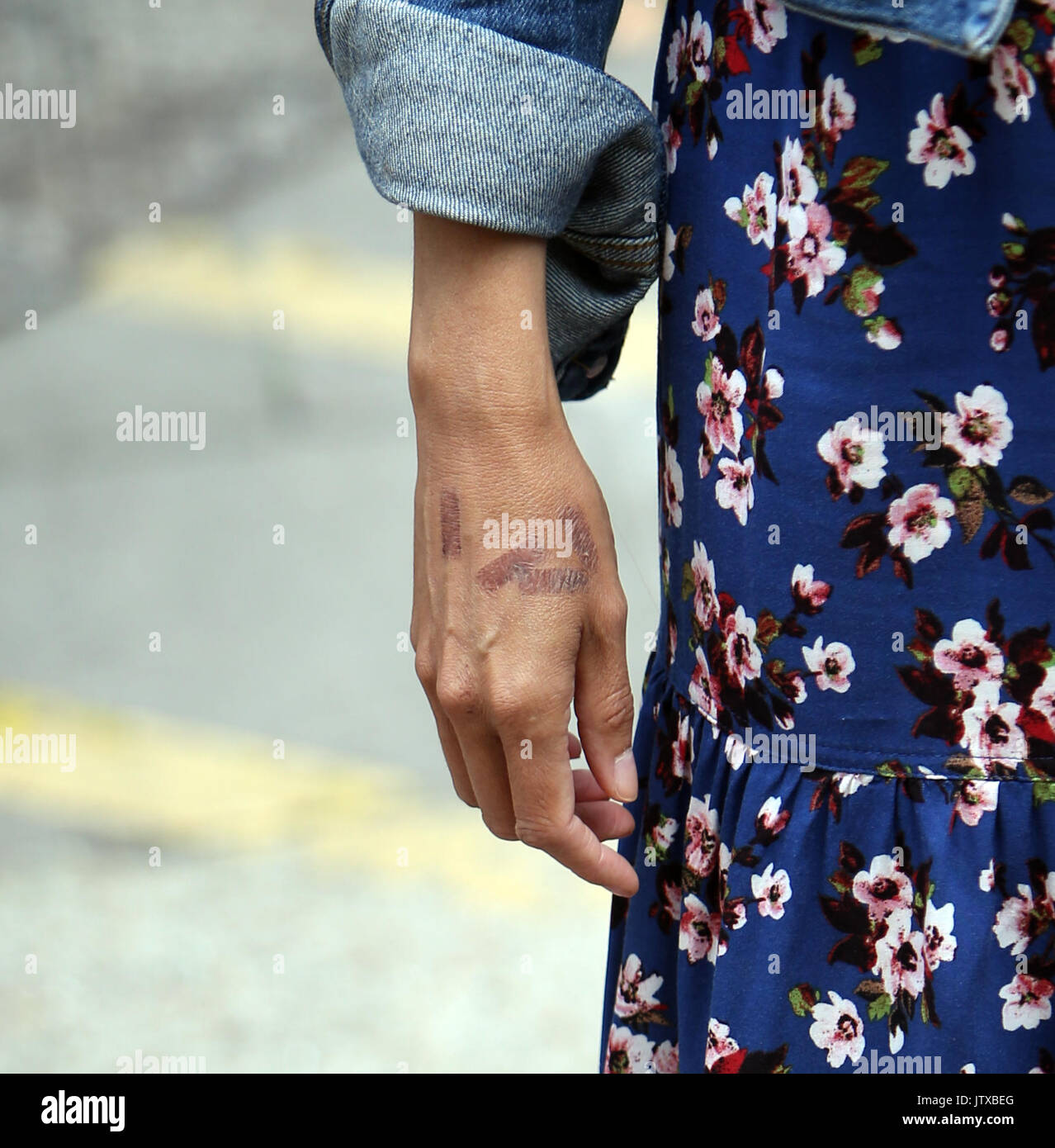 Andrea Mclean outside ITV Studios. Andrea has burns on both hands ...