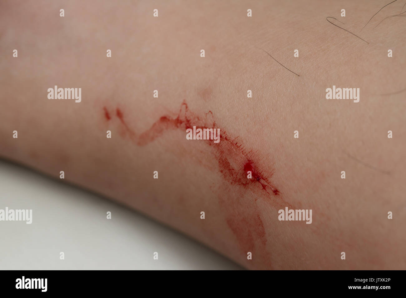 Bloody leg hi-res stock photography and images - Alamy