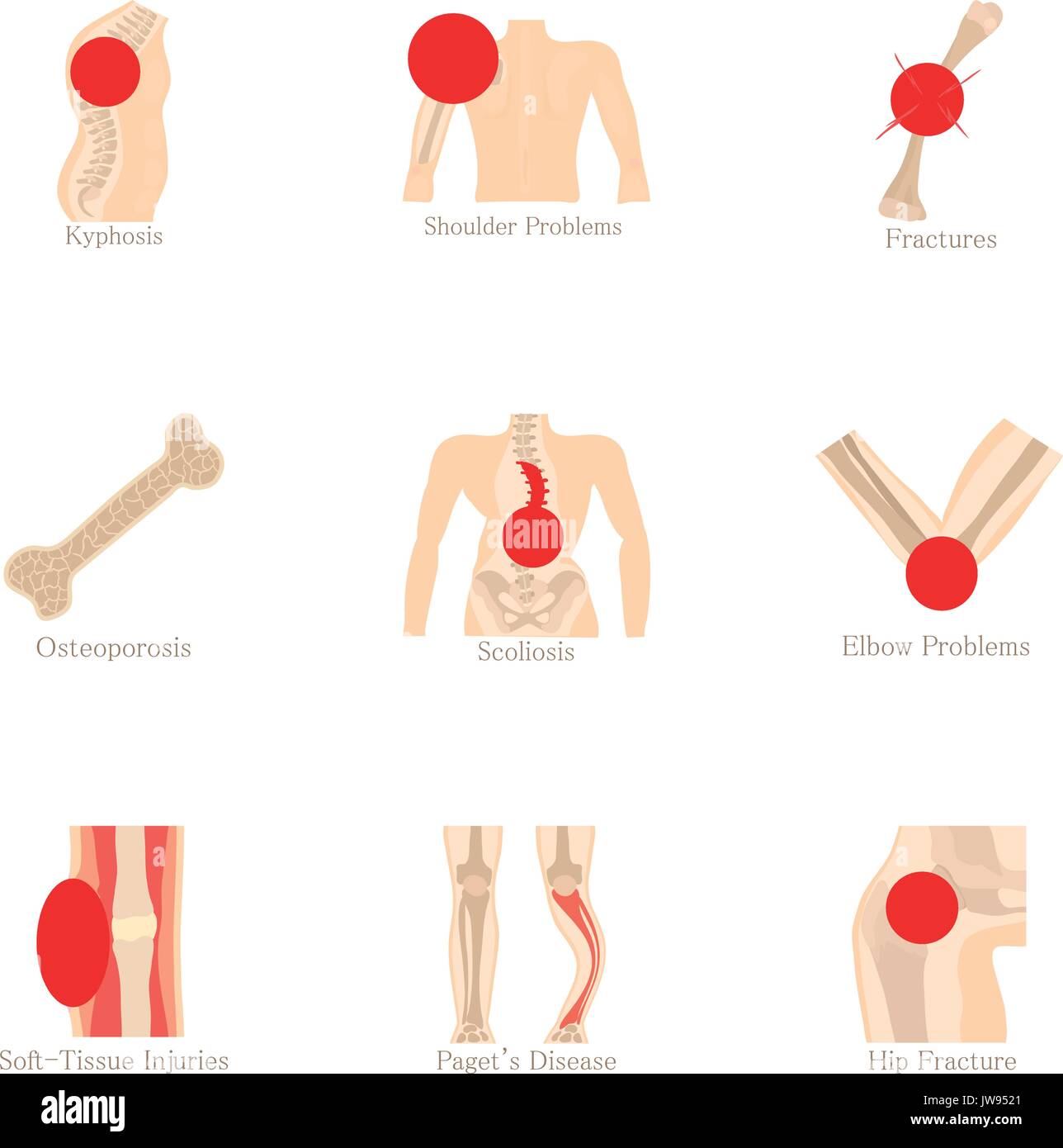 Orthopedic icons set, cartoon style Stock Vector Image & Art - Alamy