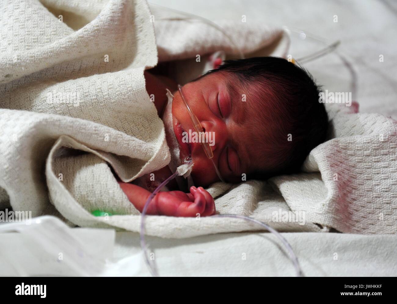 Hospital icu india hi-res stock photography and images - Alamy