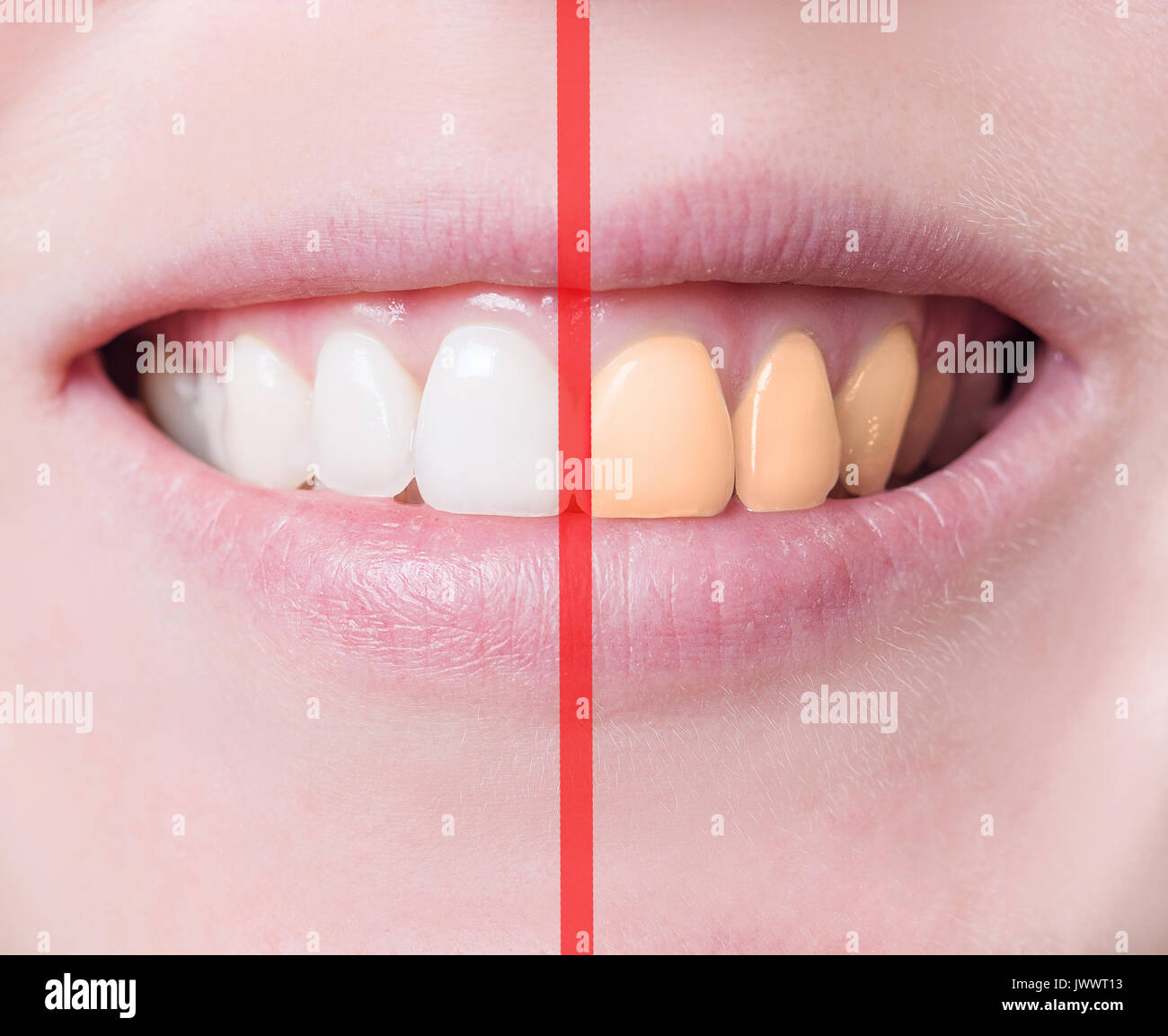 beautiful smile with white teeth Stock Photo - Alamy
