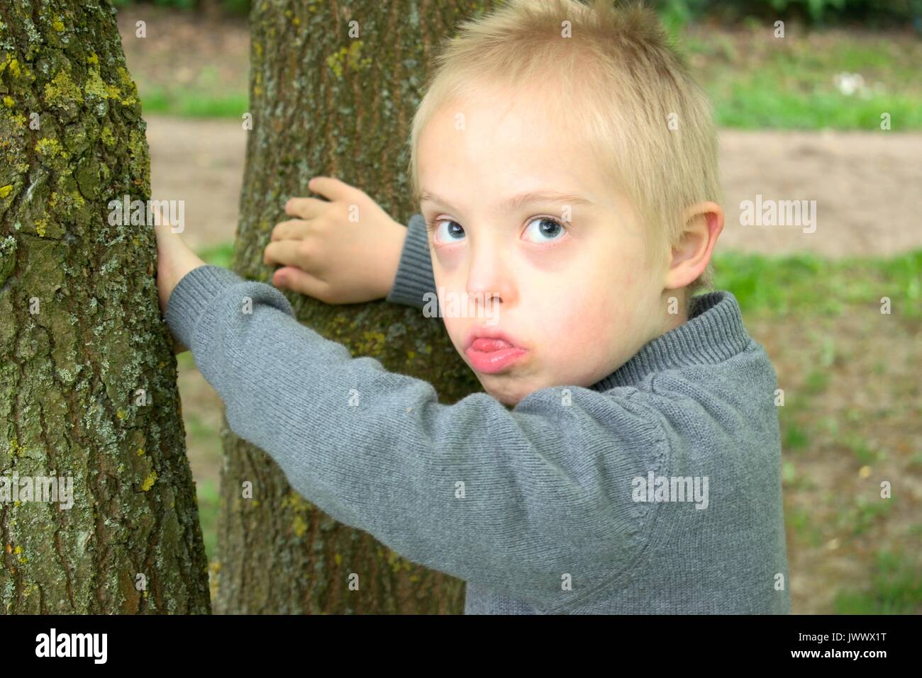 Who has downs syndrome hi-res stock photography and images - Alamy